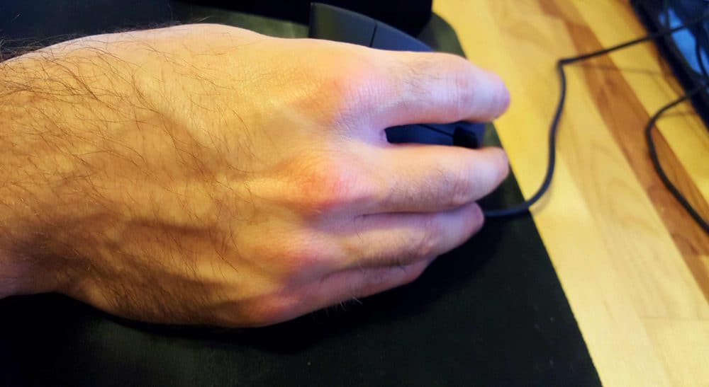 Anker Vertical Mouse Review – GoMK